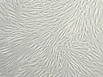 Primary Human Skin Cells