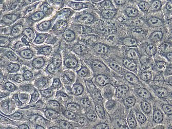 Primary Human Skin Cells